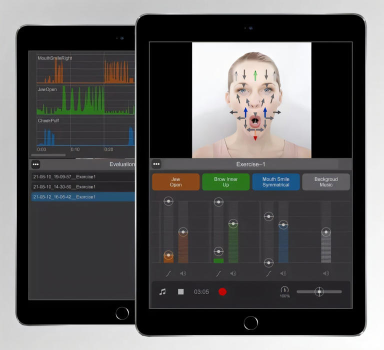 App uses music-driven facial exercises to aid stroke recovery and ...