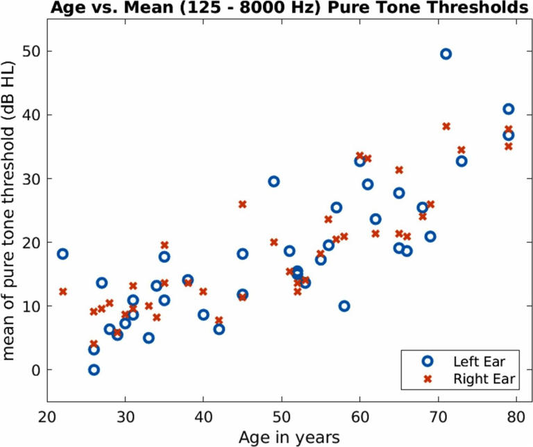 Brain networks rewire to compensate for difficulty hearing speech in ...