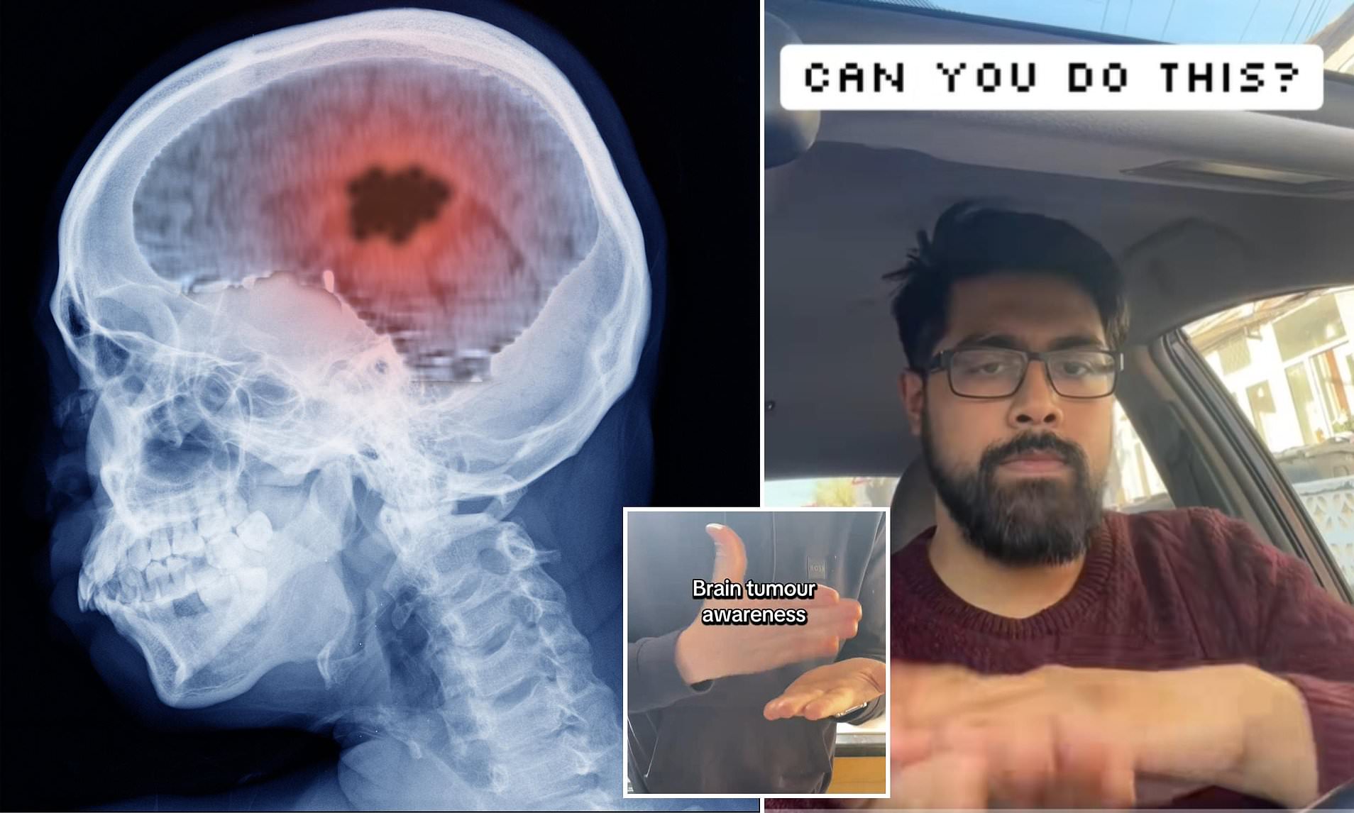 Medic demonstrates 30-second hand test that could reveal if you have a ...