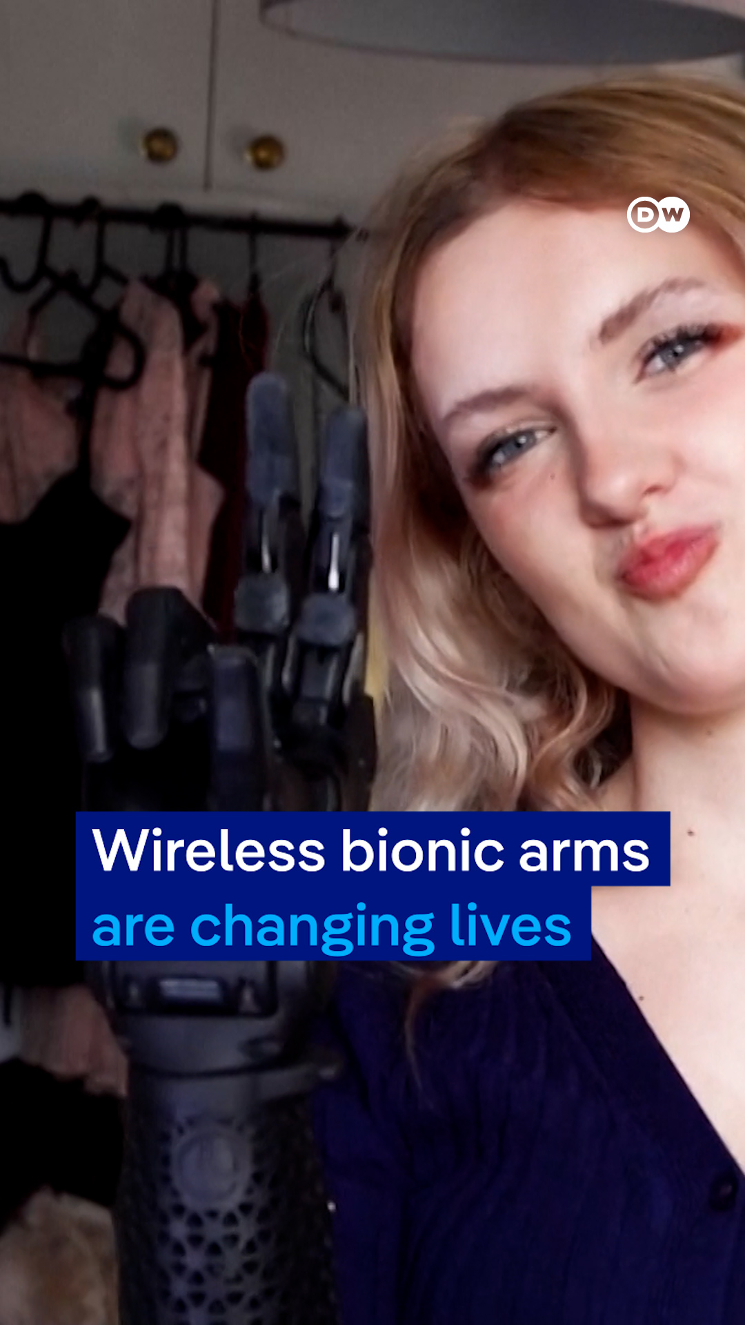Wireless bionic arms are changing lives