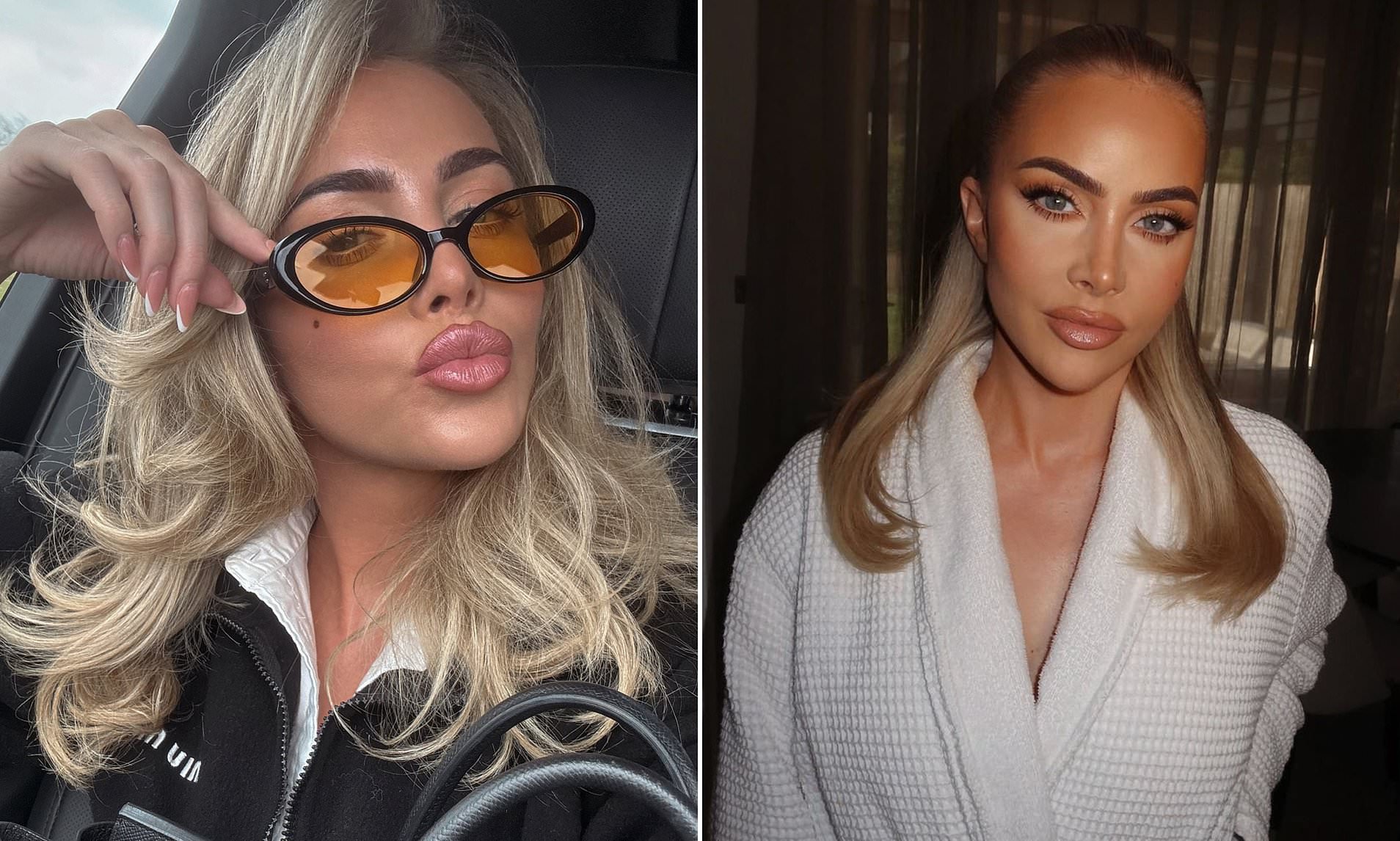 Eddie Stobart heir's wife: I've had so much cosmetic surgery my ...