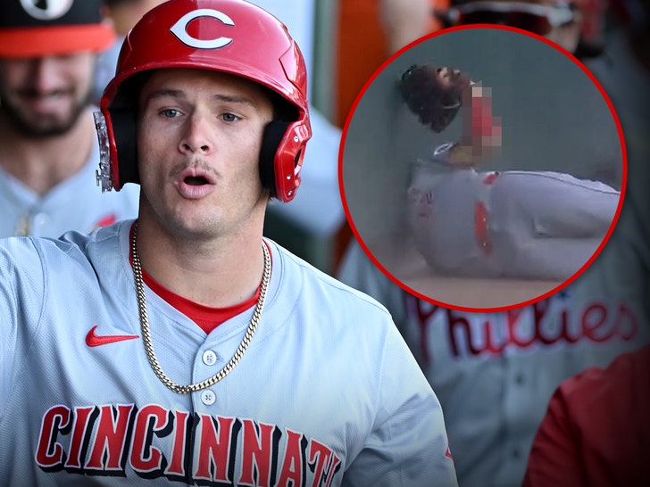 Reds' Tyler Callihan Has Surgery On Gruesome Arm Fracture, Out 2 Months