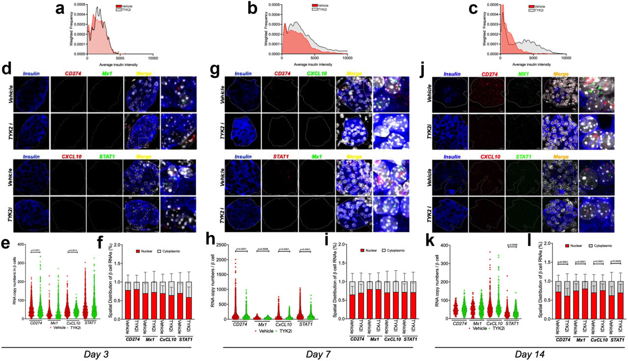 Dual-action approach targeting inflammation shows potential as type 1 ...