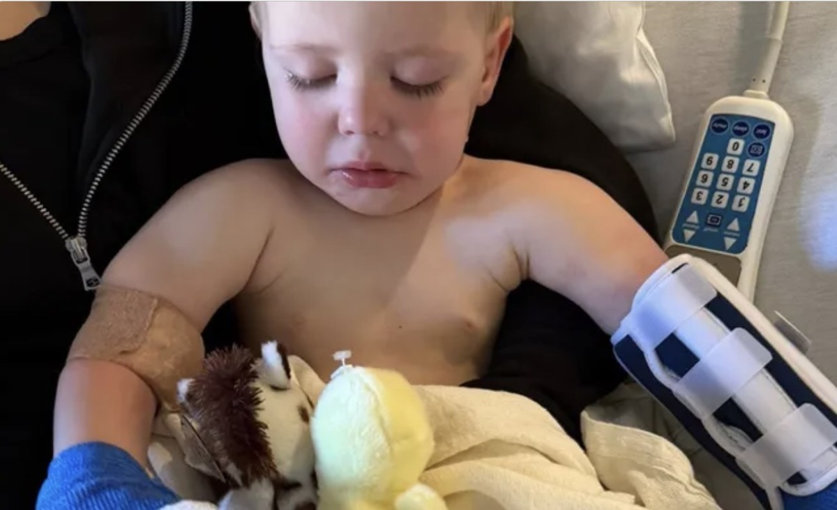 Toddler hospitalized with severe burns after falling into fire pit