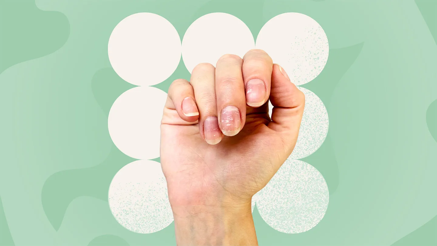 What Causes White Spots on Nails?