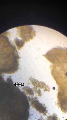 Did You See the Bacteria? | Tonsil Stone Under the Microscope