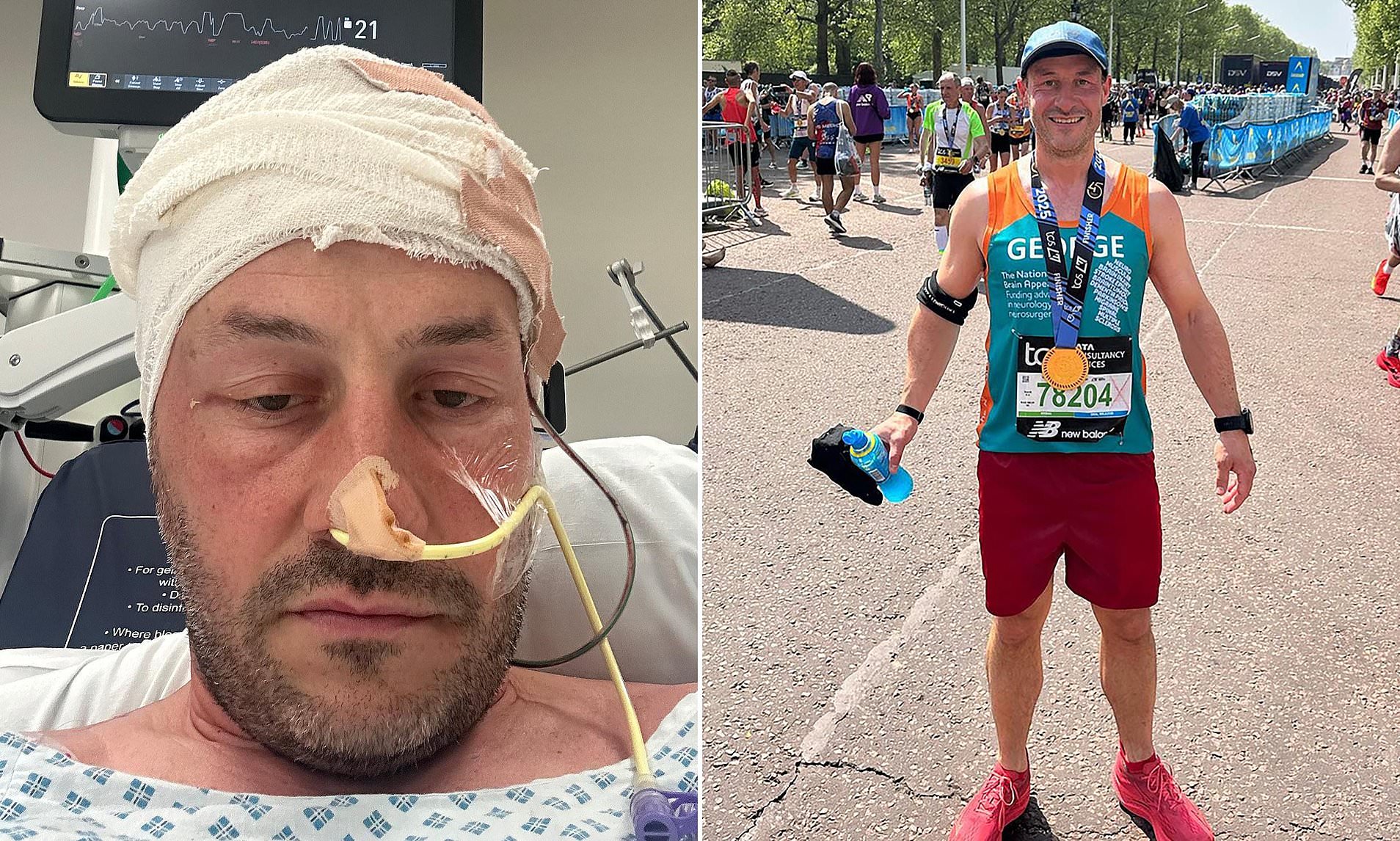 Healthy runner, 40, hit by TWO killer brain tumours - early sign was ...