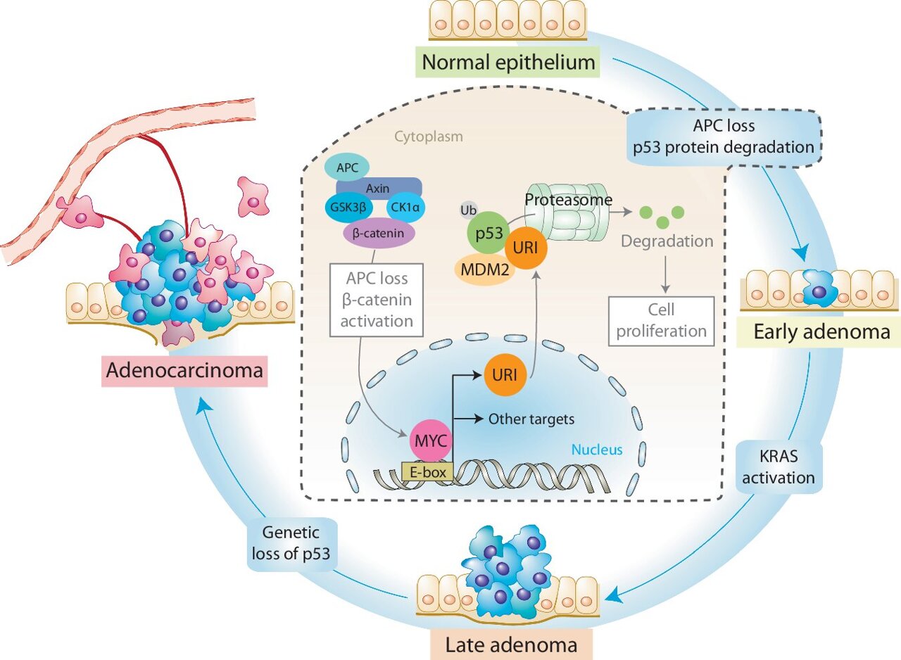 Molecular mechanism that initiates colon cancer opens new path for ...