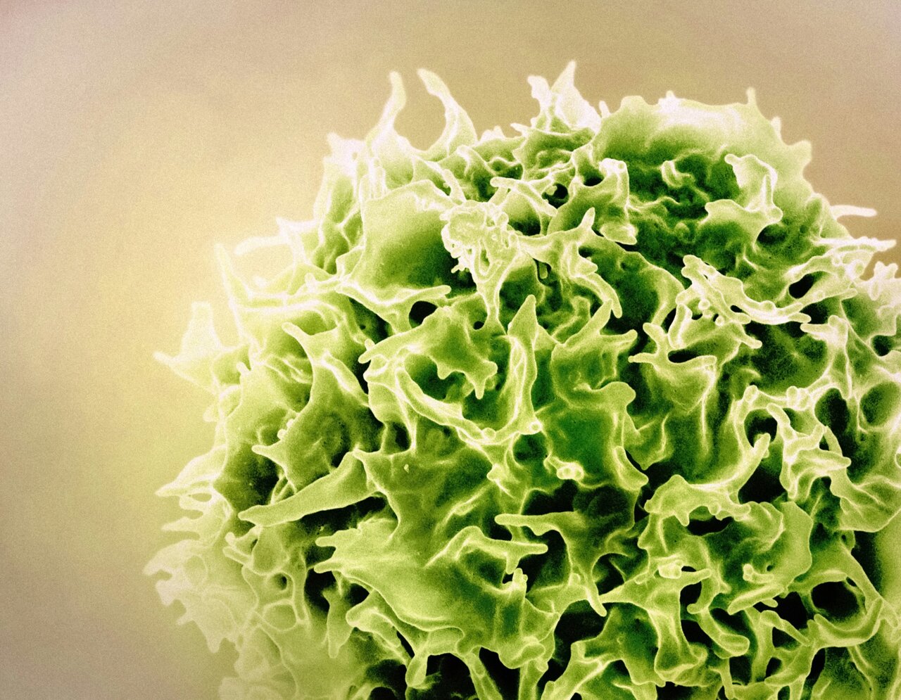 Little-known enzyme could supercharge immune cells to tackle cancer