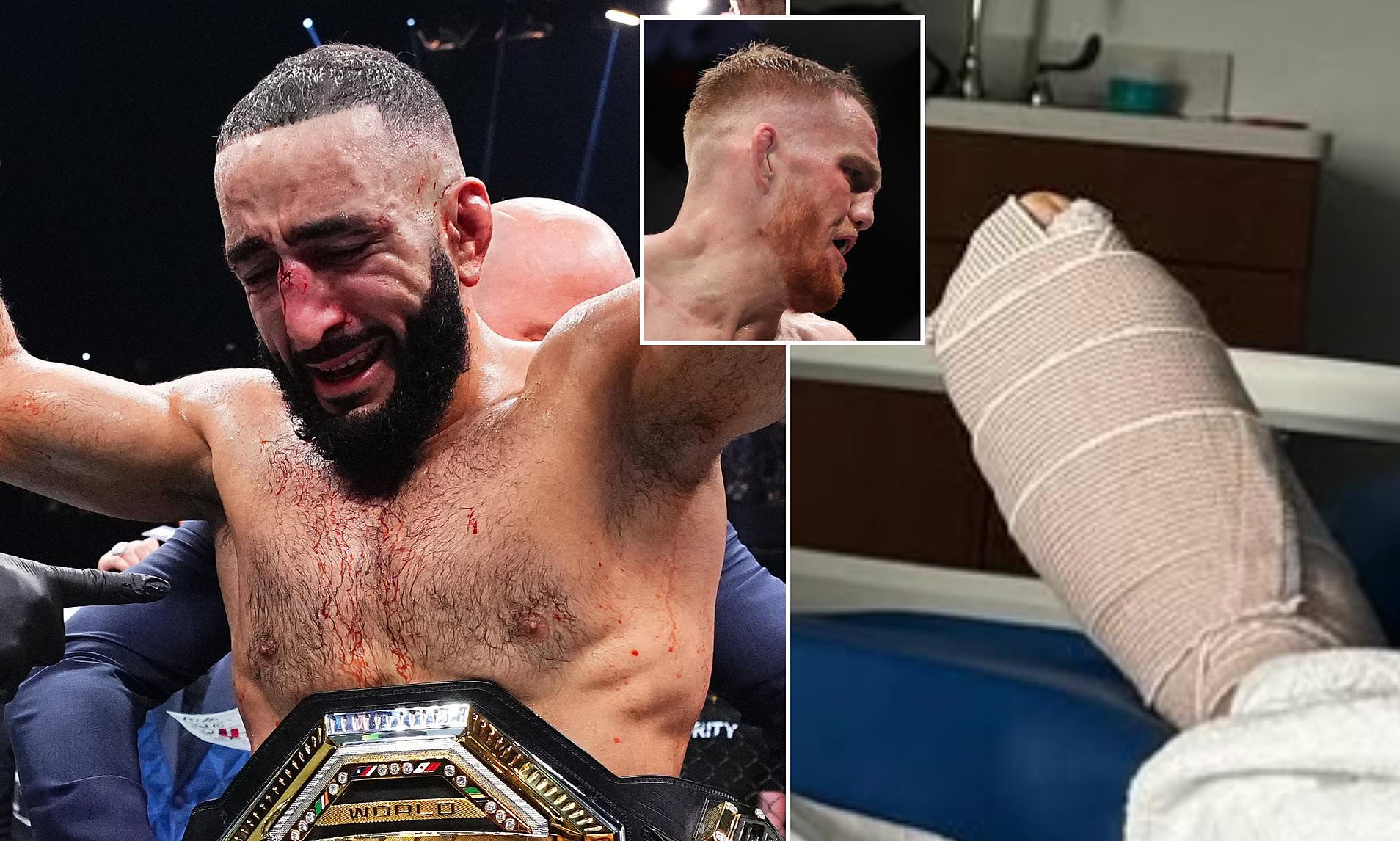 Belal Muhammad reveals how he 'almost had foot AMPUTATED' six months ago, as he lifts lid on ...