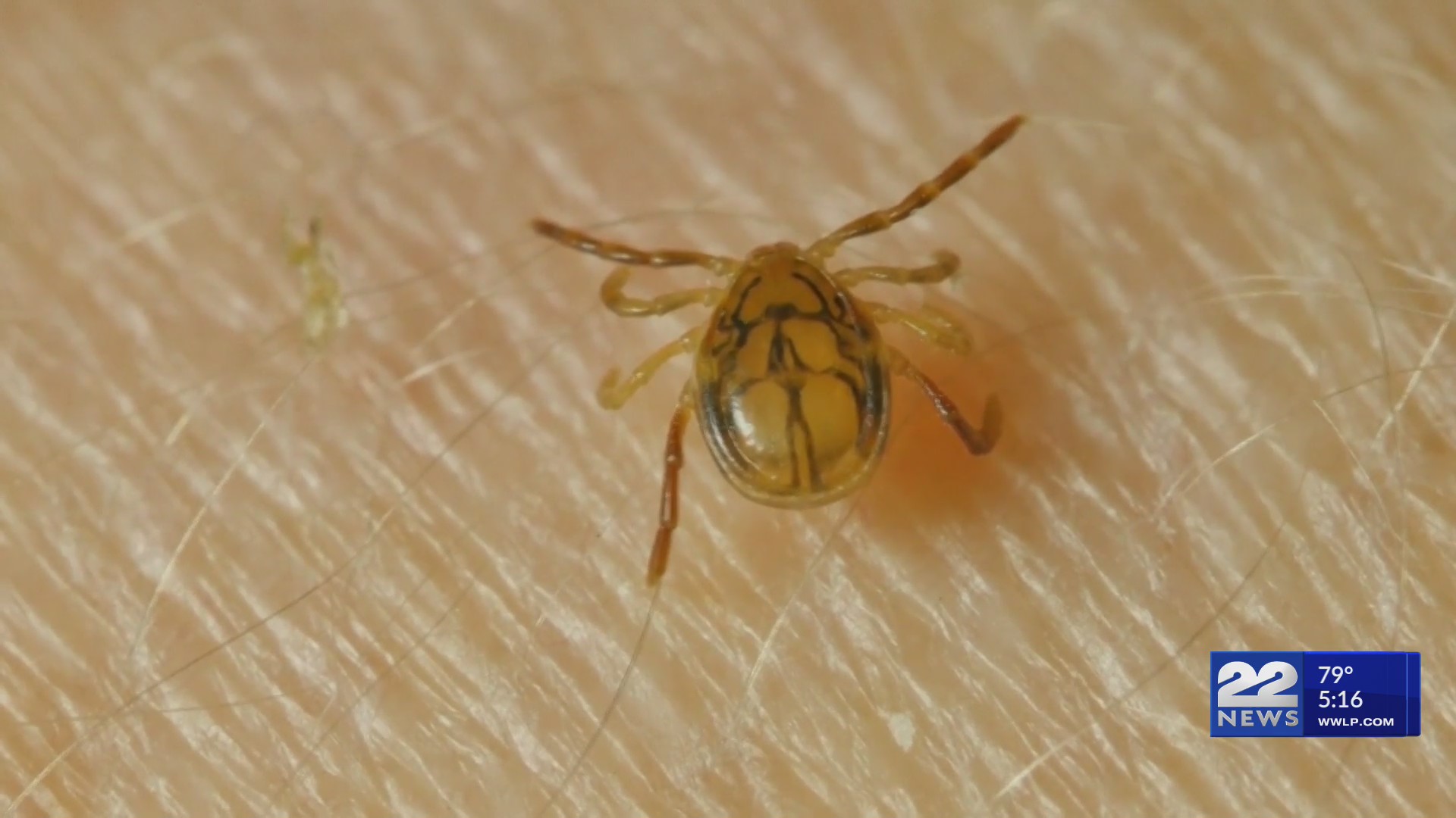 What to do if you discover a tick bite and how to prevent Lyme disease