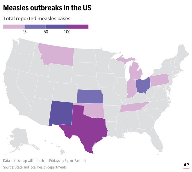 North Dakota is 11th US state with a measles outbreak. Here's what to know