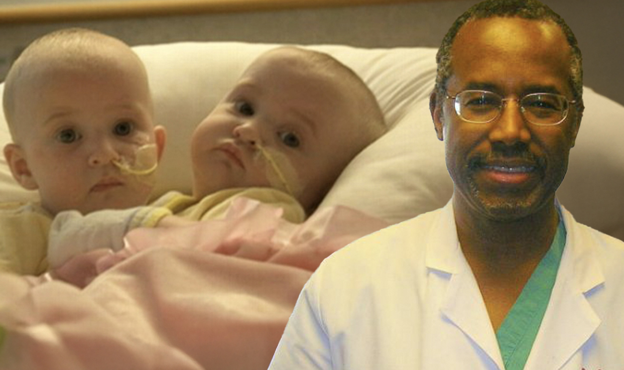 Before running for President, Ben Carson was the first doctor to ...