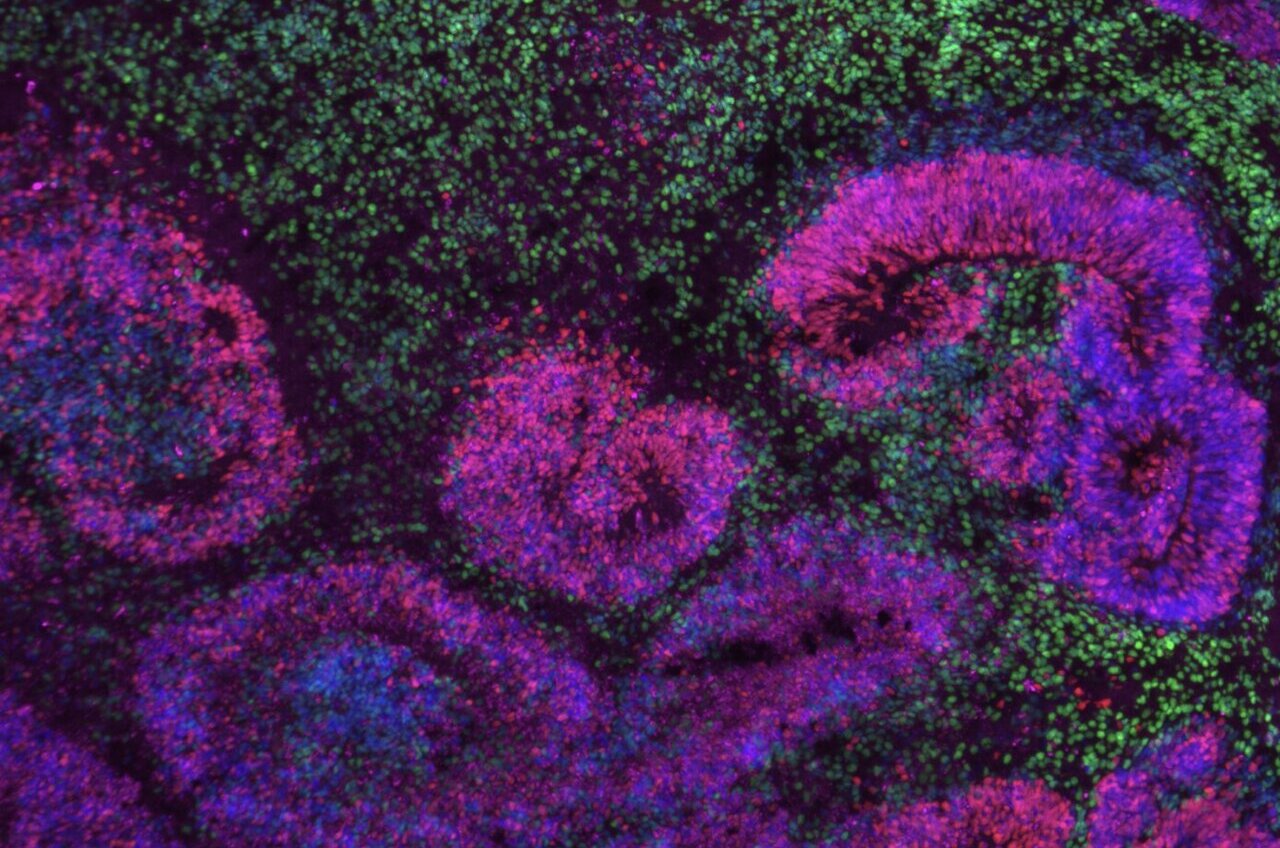 Study uncovers gene networks driving the development of distinct neuron ...