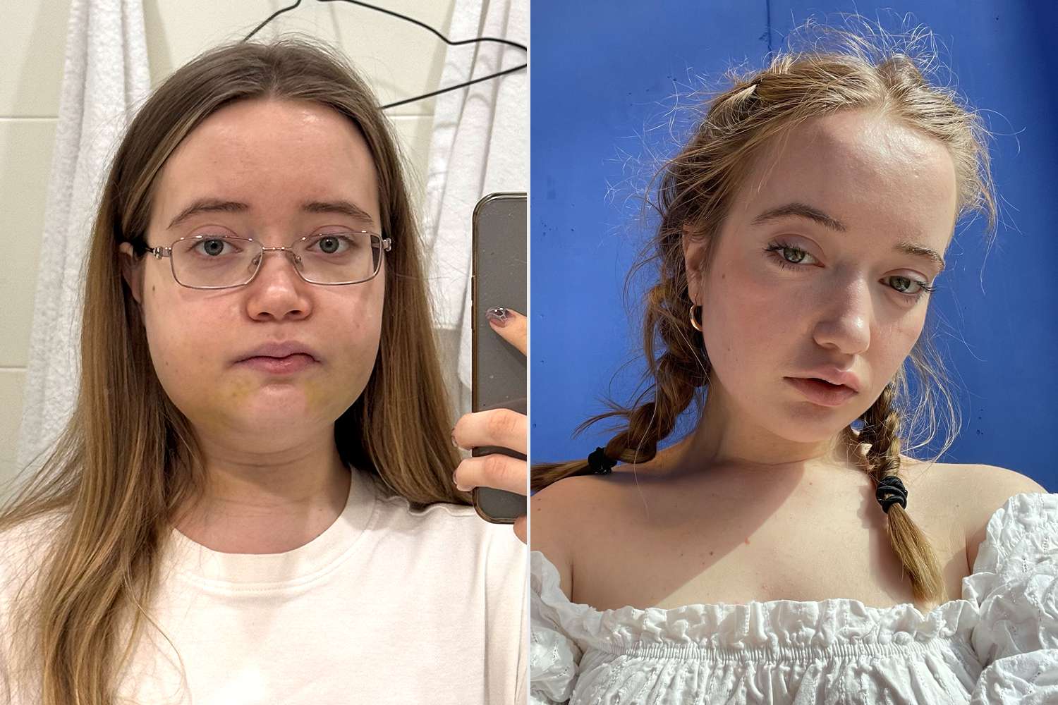 Singer Traveled 24 Hours for Pricey Double Jaw Surgery. She Never ...