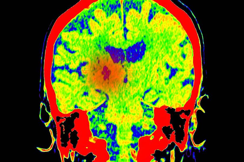 One weekly task can 'slow down' brain aging and cut risk of dementia ...
