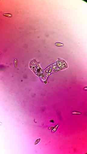 Amoeba Under the Microscope – Strange Shapes and Motion Revealed