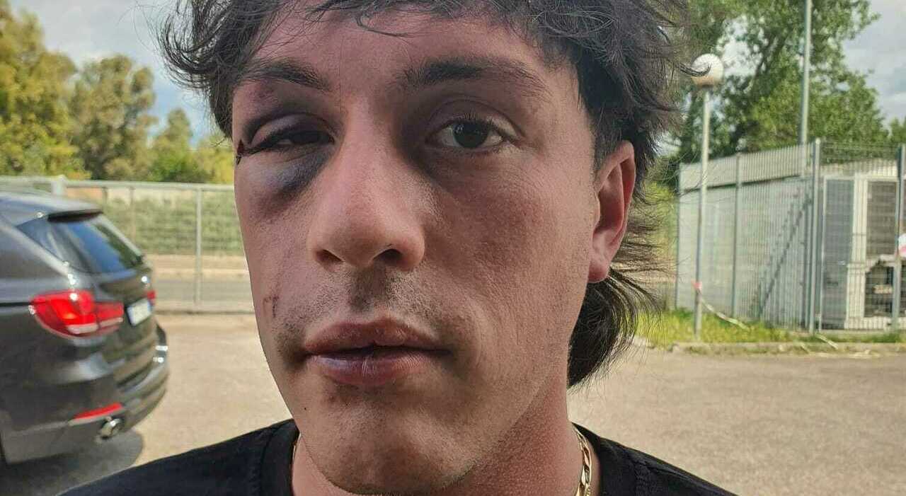 Michael Lunetta, pestato da due uomini a via Tiburtina: stava ...