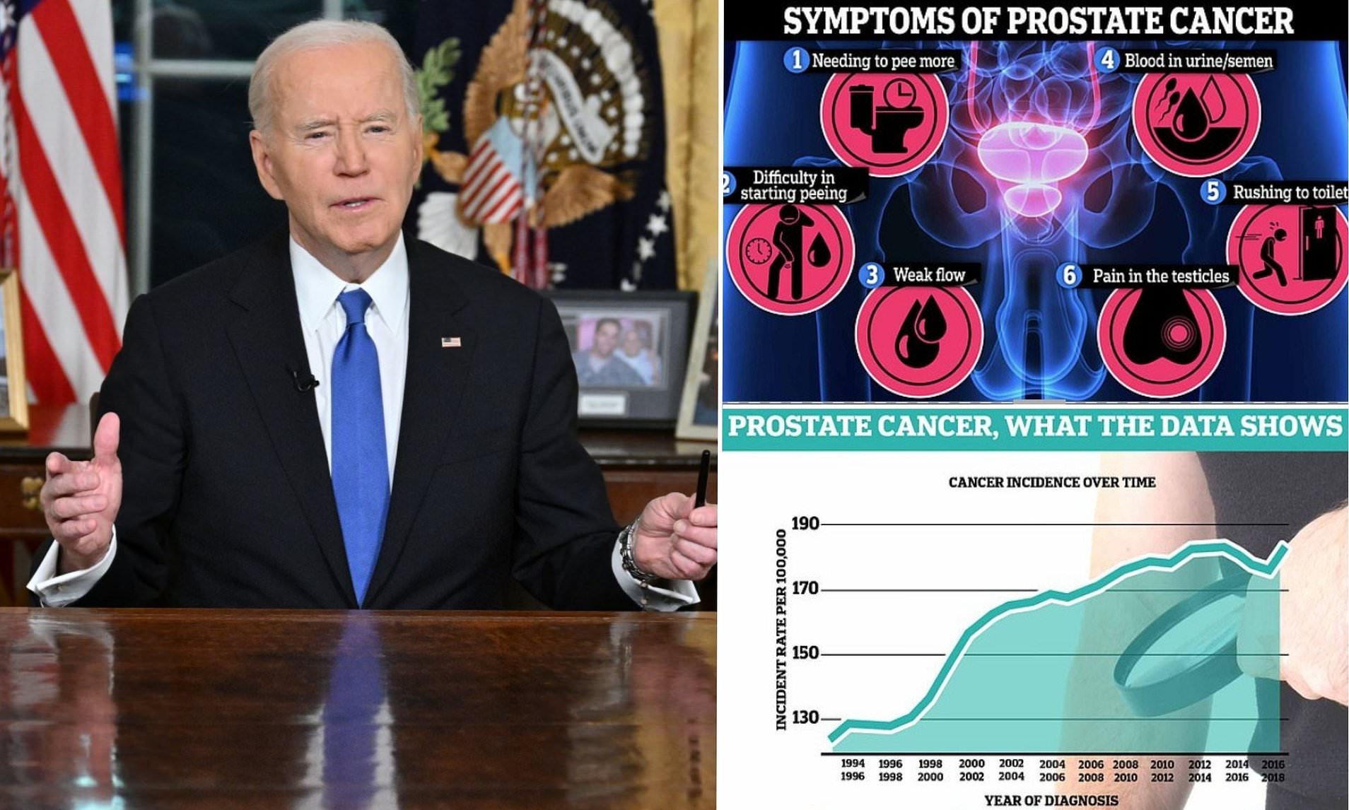 Experts reveal bleak prognosis for men with advanced prostate cancer ...