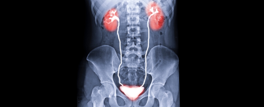 World's First Bladder Transplant Gives Cancer Patient New Hope