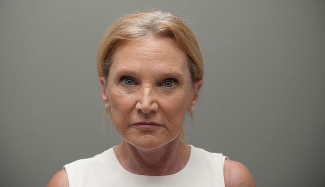 Woman, 67, 'Couldn't Close' Her Eye After Botched Facelift. One 4-Hour ...