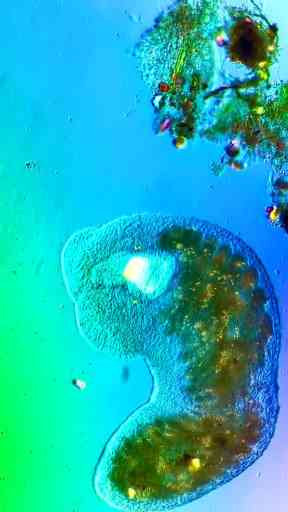 Microscopic Look at Worms – Strange Creatures in Detail