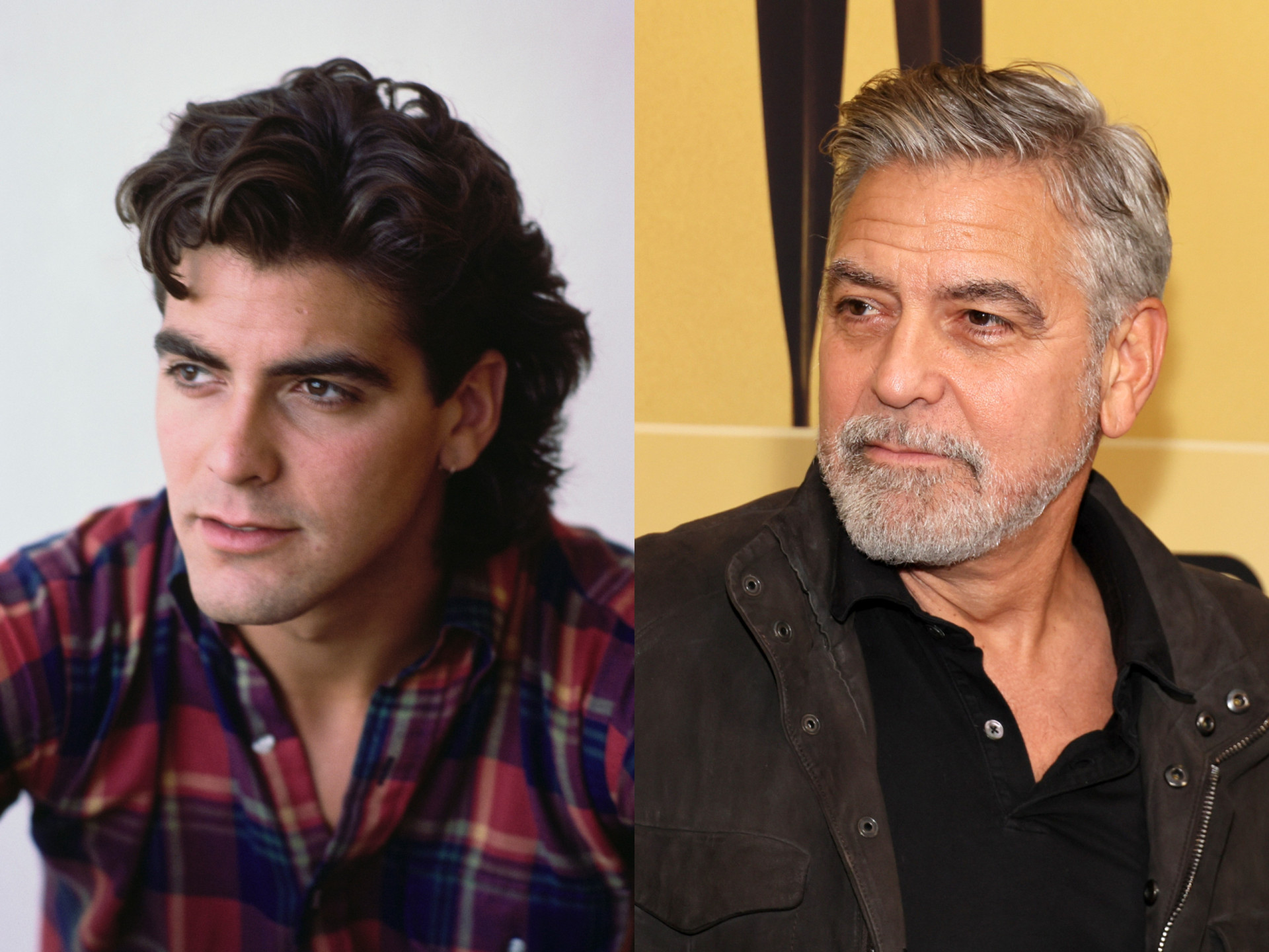 Prima e dopo: celebrità stravolte dalla chirurgia estetica