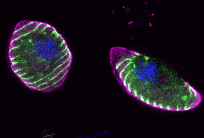 Trace the Evolution of Malaria Parasite Proteins