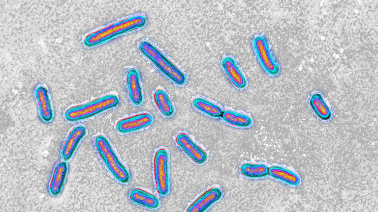 Hospital superbug can feed on medical plastic, first-of-its-kind study ...