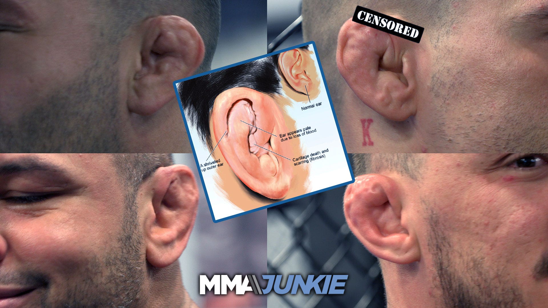 Video: UFC fighters share first cauliflower ear experience and painful ...