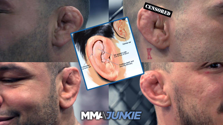 Video: UFC fighters share first cauliflower ear experience and painful ...