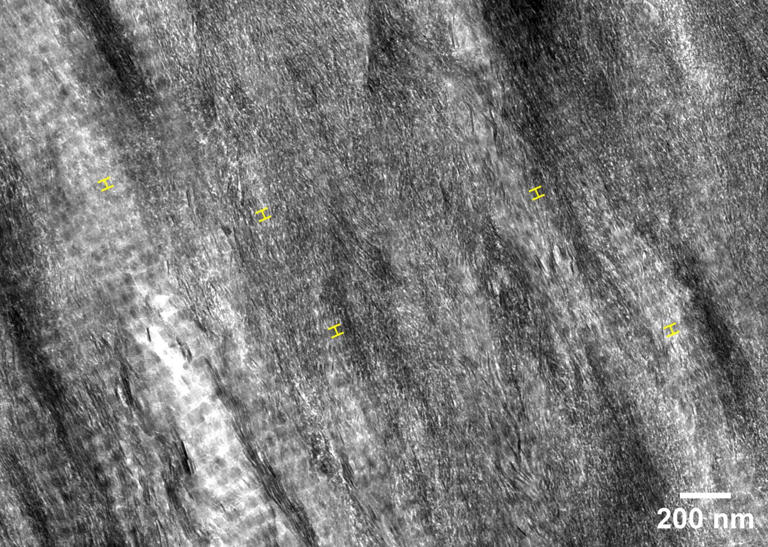 'Sharkitecture:' A nanoscale look inside a blacktip shark's skeleton