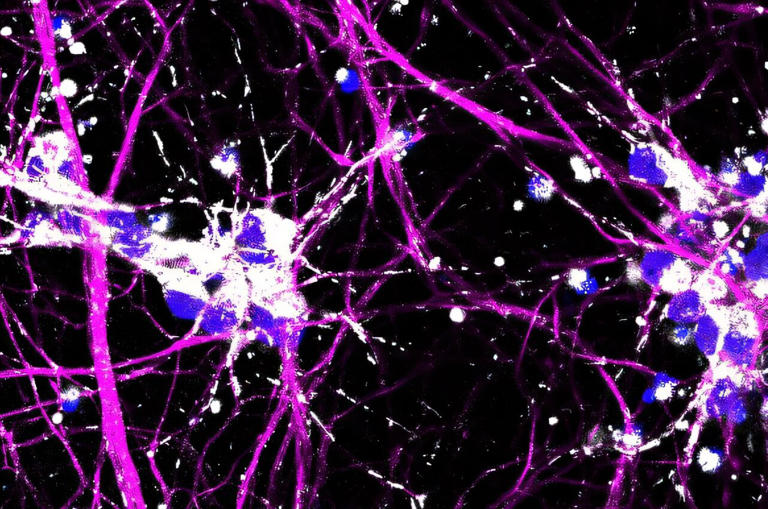 CRISPR study reveals mitochondrial dysfunction as early marker in ...