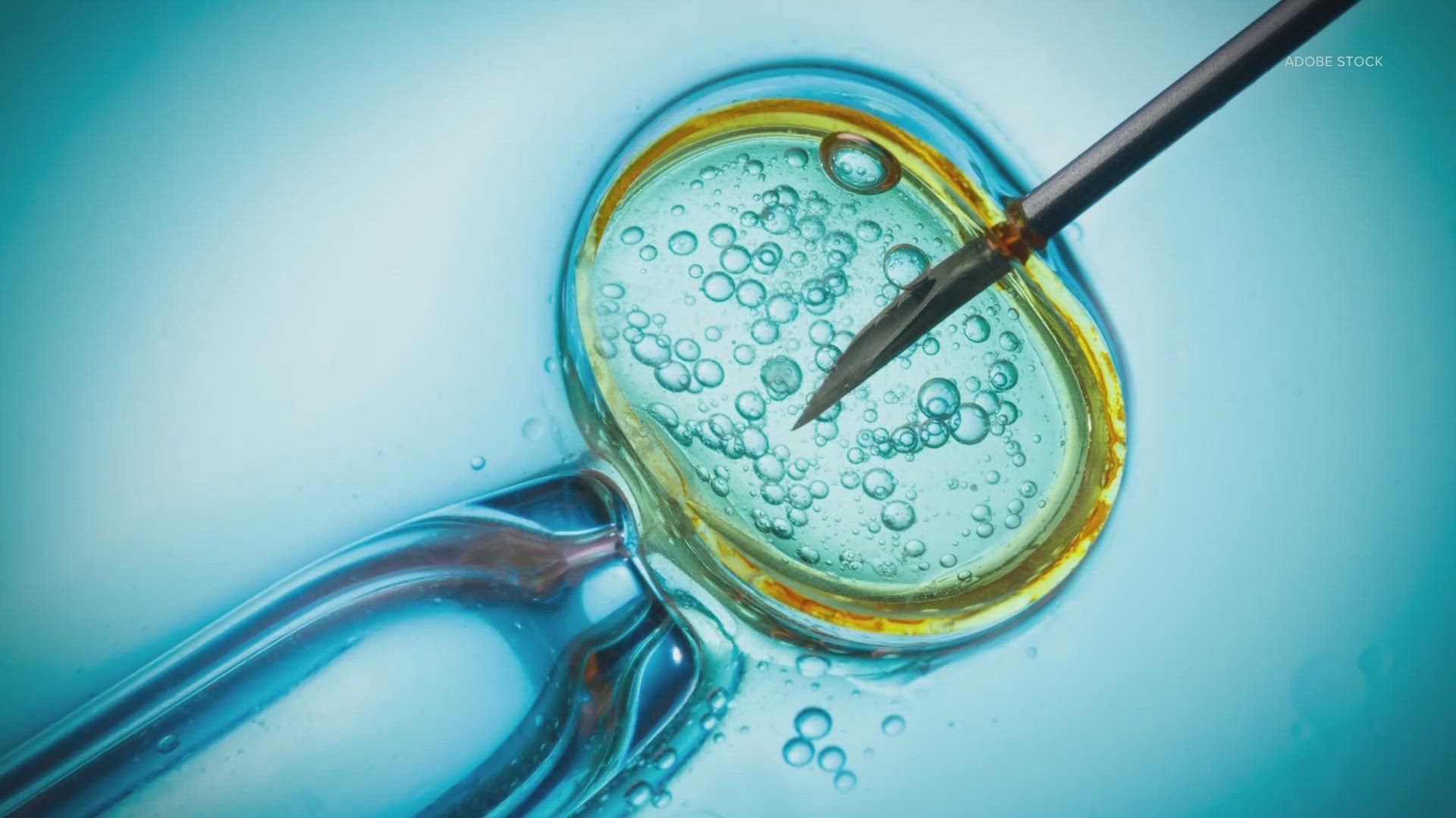 IVF: What to know about the process of in vitro fertilization