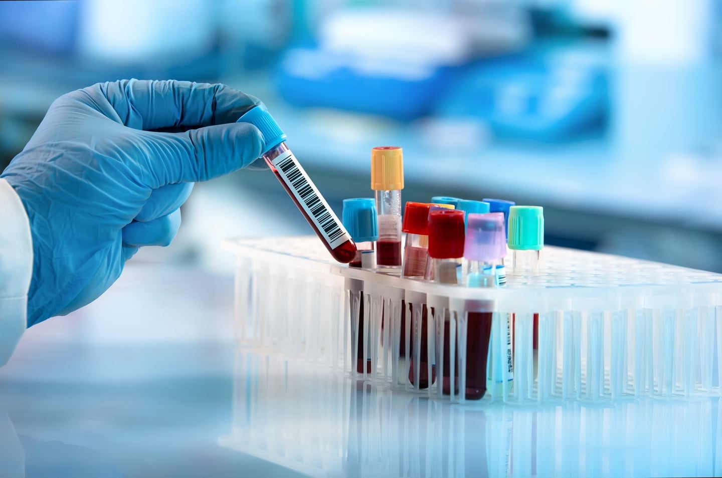 SeekIn announces clinical validation of multi-omics blood test in study