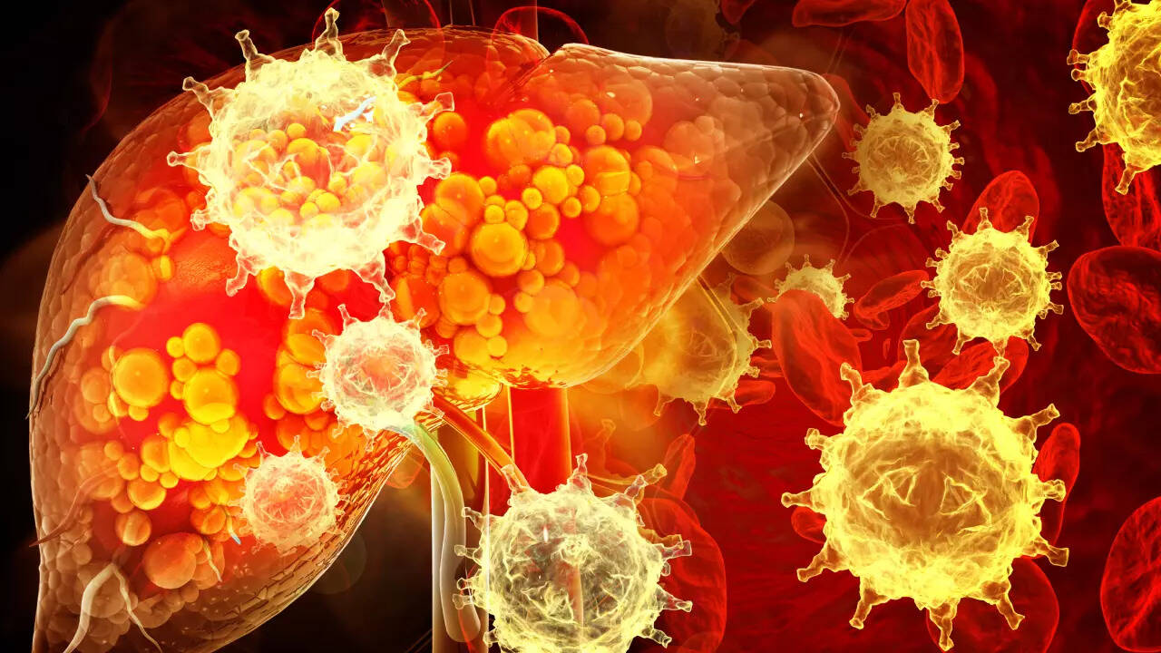 Dipika Kakar diagnosed with stage 2 liver cancer: 5 crucial signs and ...