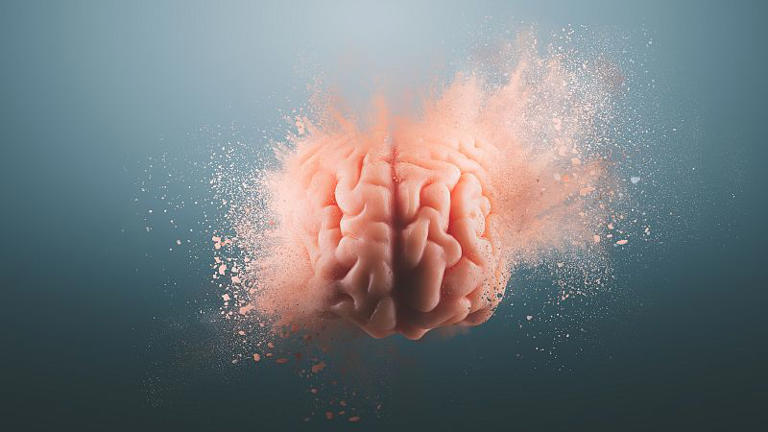 Is 'brain rot' real? Experts weigh on on the impact of excessive screen ...