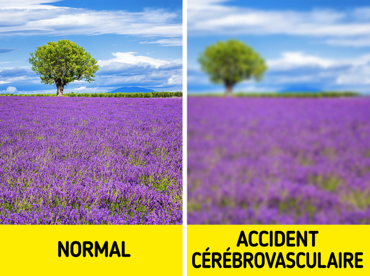 12 Signes étranges dans tes yeux qui pourraient cacher un souci de santé