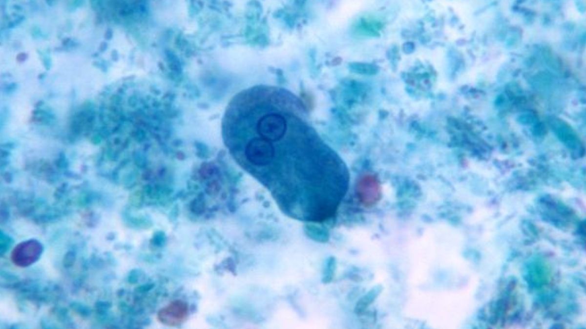 Ce parasite se déguise en cellule humaine pour échapper à notre système ...