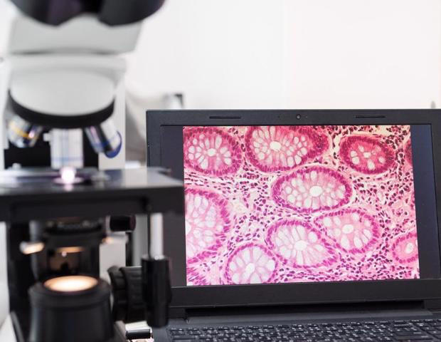 Ultrack Enables Fast and Accurate Cell Tracking in 3D Embryo Imaging