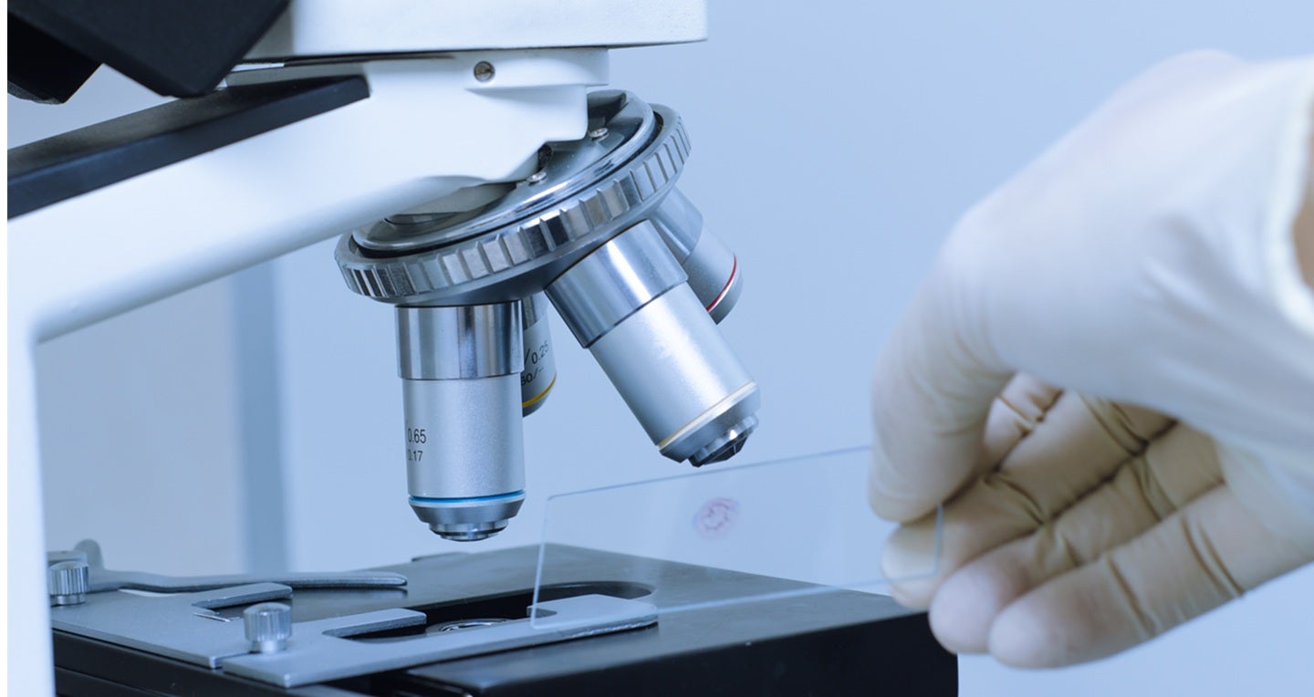 SAGA Diagnostics launches multi-cancer MRD platform in US