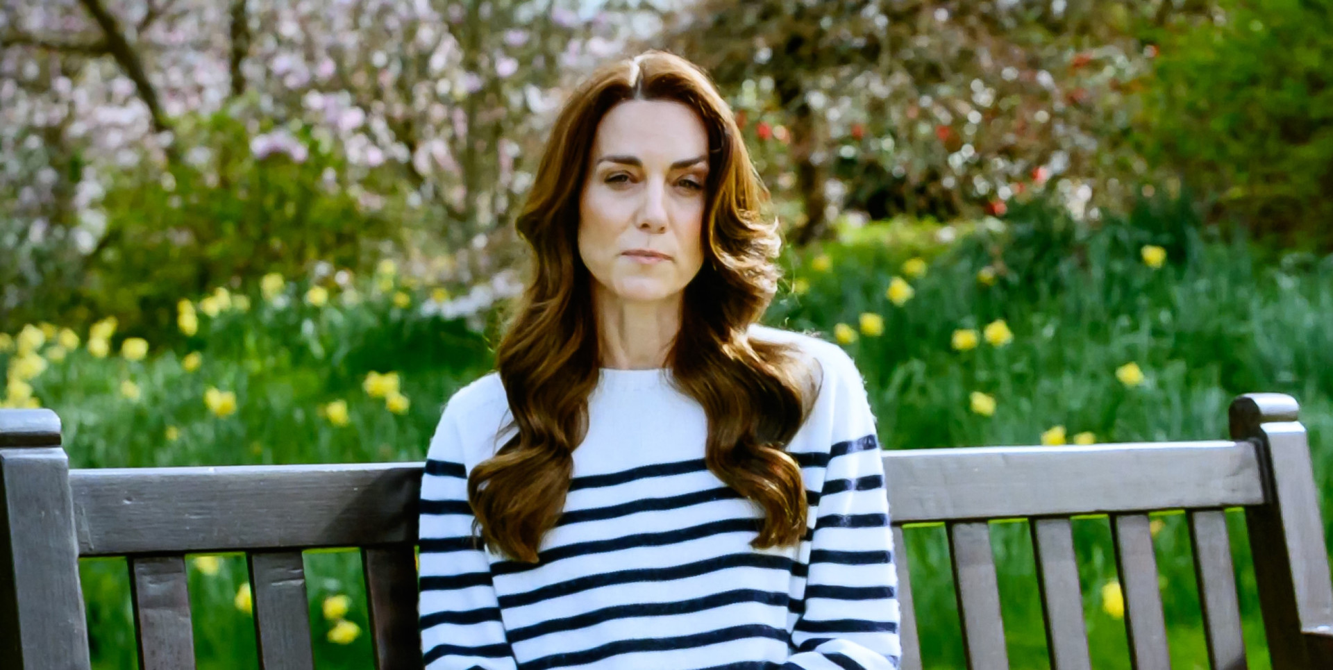 Modern-day royals and their medical conditions