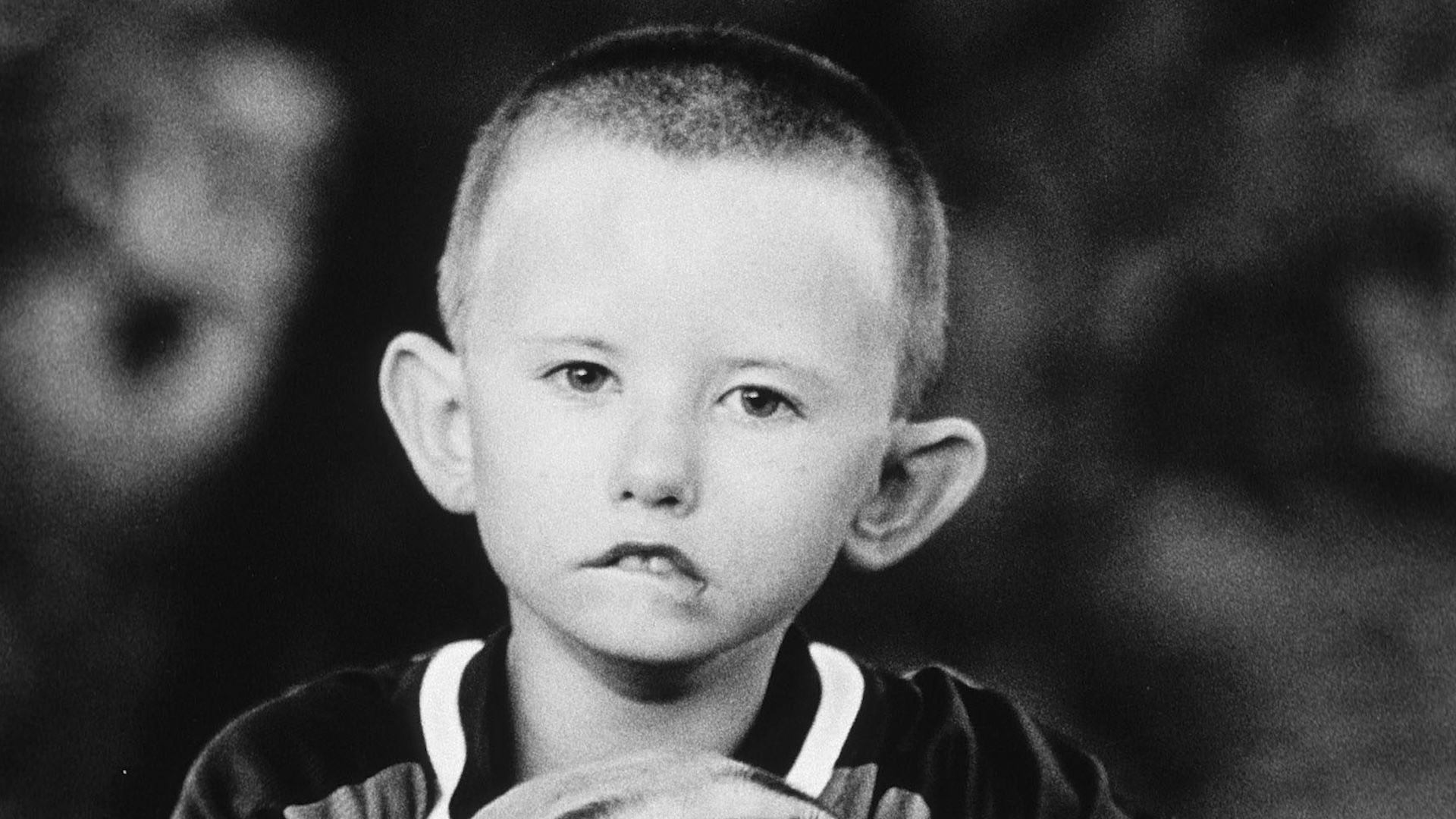 Moebius syndrome: The rare condition that makes people unable to smile