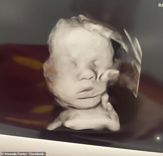 'Hand of God' mysteriously appears in ultrasound after mom prays for ...