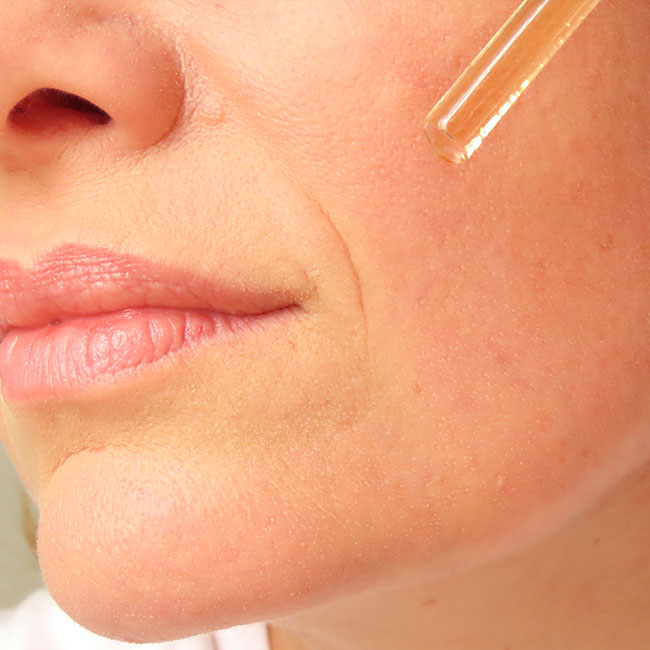 Combine These 2 Science-Backed Skincare Ingredients To 'Lift And ...