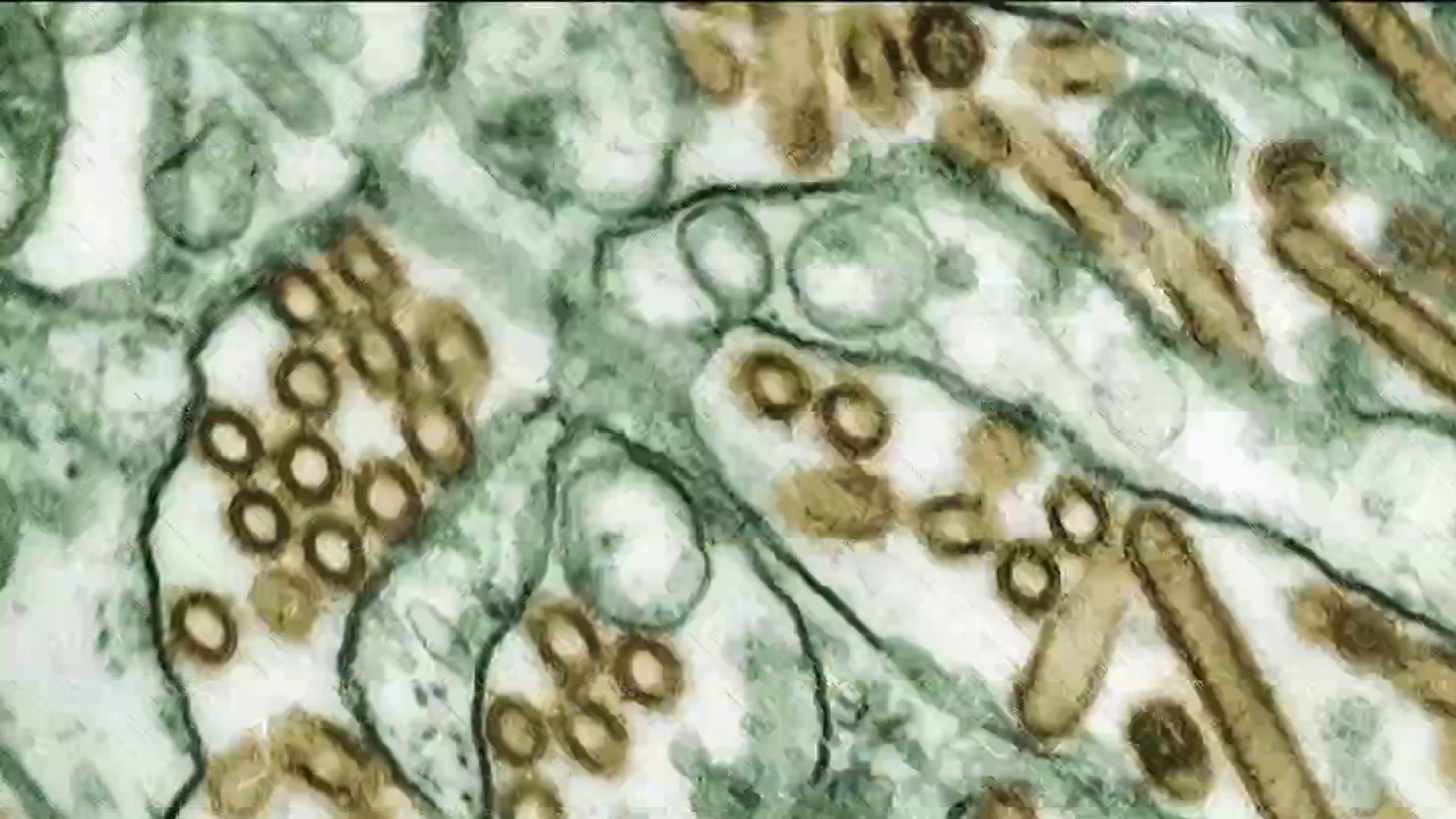 HHS cancels $766M in funding for Moderna to develop MRNA vaccine against bird flu