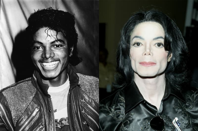 Michael Jackson's Many Cosmetic Surgeries