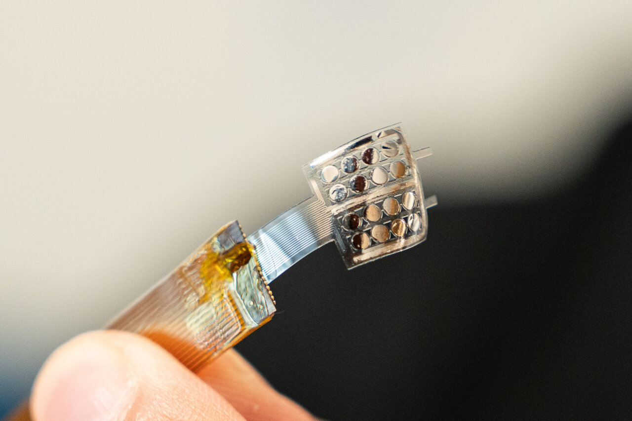 Real-time sensors quantify biomarkers to inform better wound care