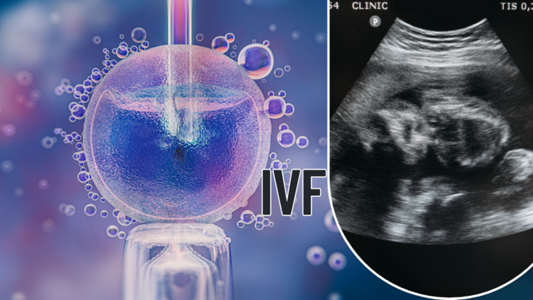 IVF: What Is The Right Age To Start, How Many Times You Can Try And ...