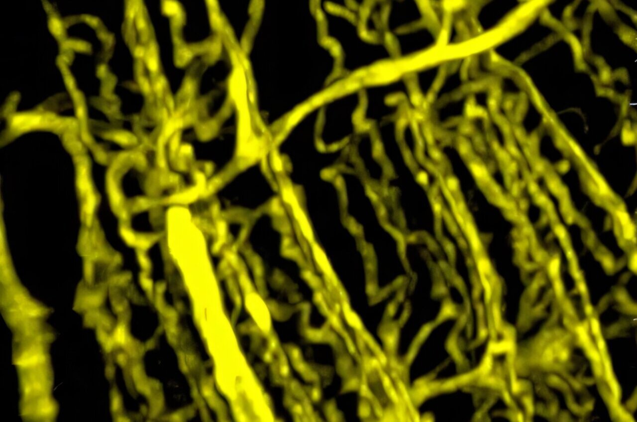 Poorly functioning blood vessels linked to muscle wasting in cancer